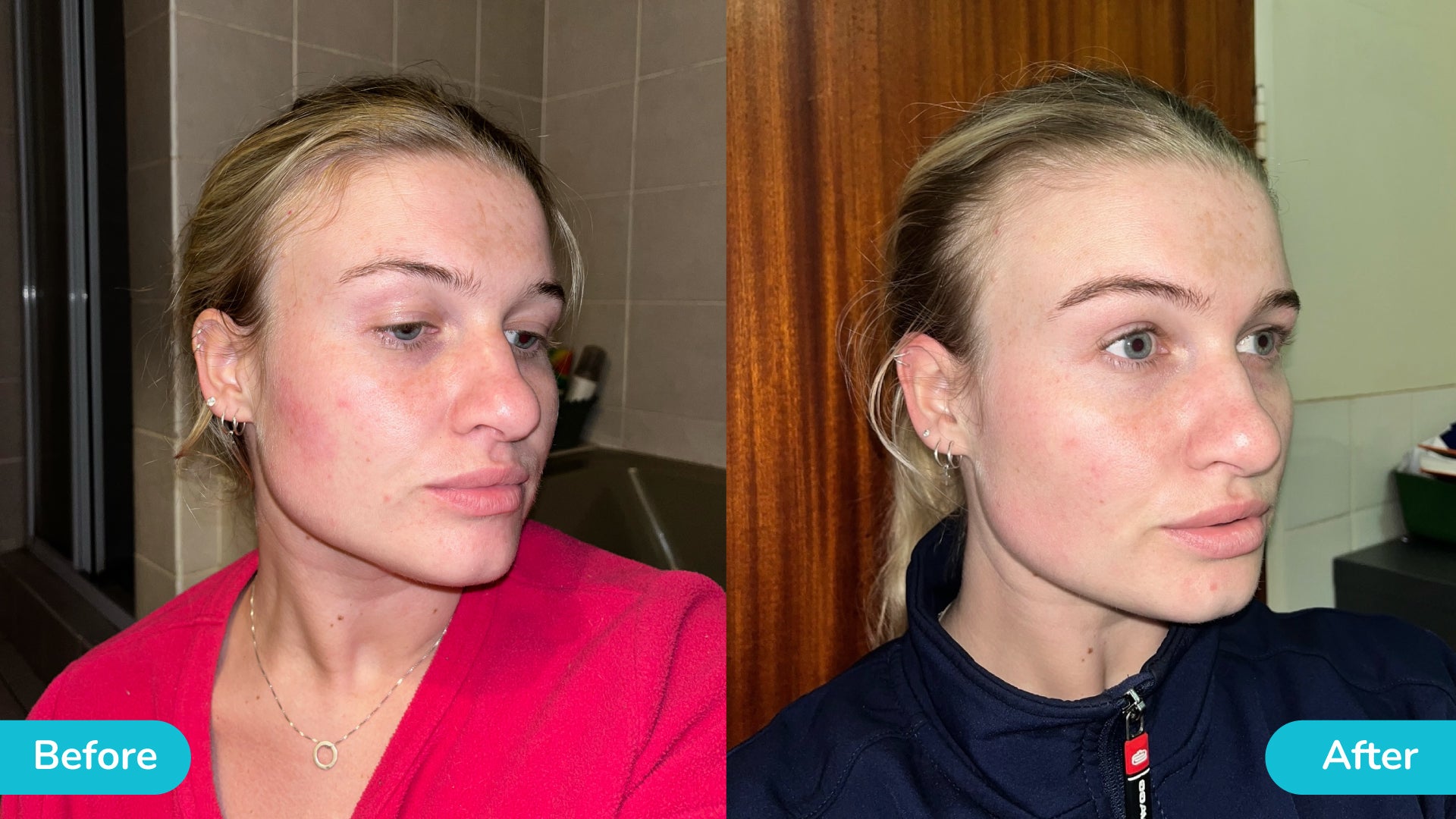 Luminous Skin Glow With Collagen – Motherkind Co